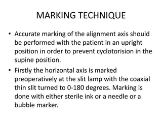 Toric iol | PPTX