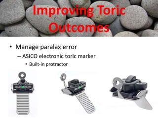 Toric IOL's and Cataract Surgery | PPSX