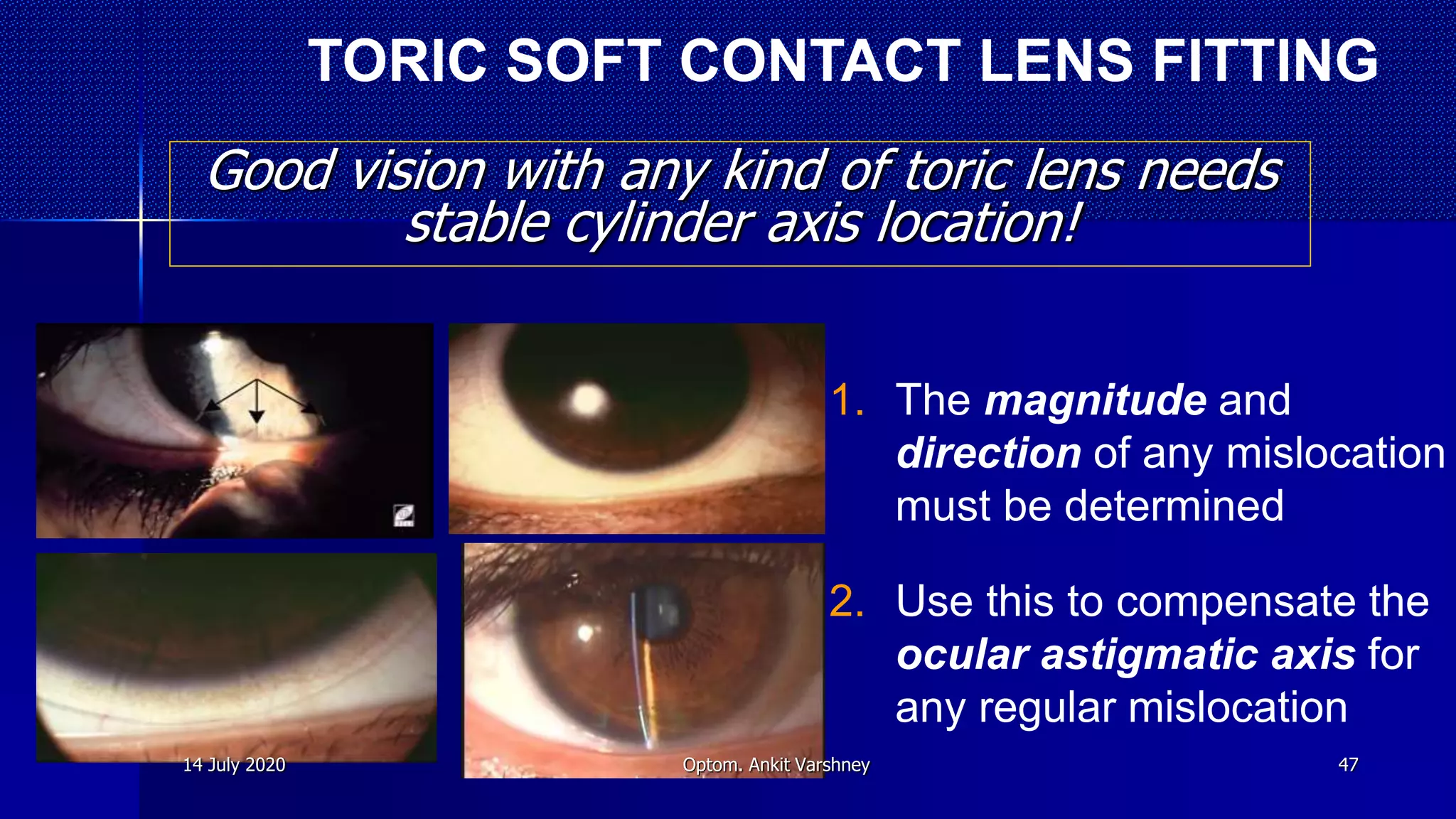 Toric soft contact lenses by optom ankit varshney | PPTX