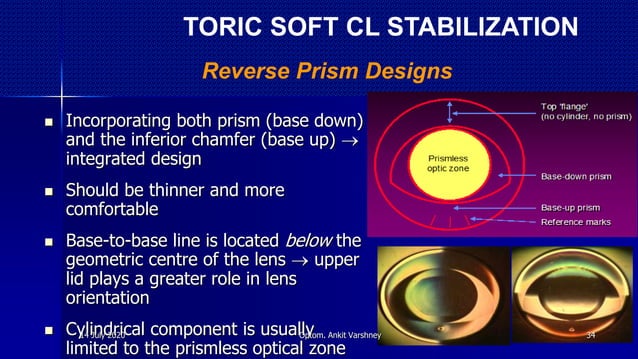 Toric soft contact lenses by optom ankit varshney | PPT