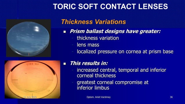 Toric soft contact lenses by optom ankit varshney | PPTX | Eye and ...