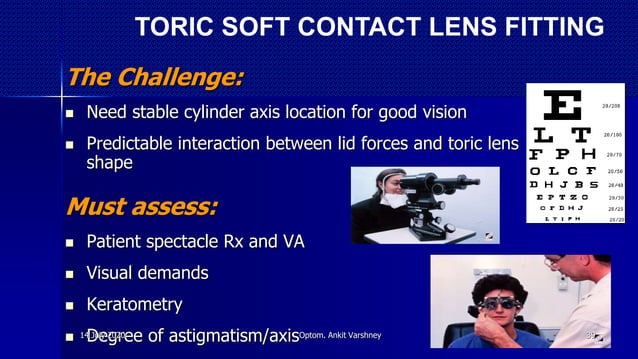 Toric soft contact lenses by optom ankit varshney | PPTX | Eye and ...