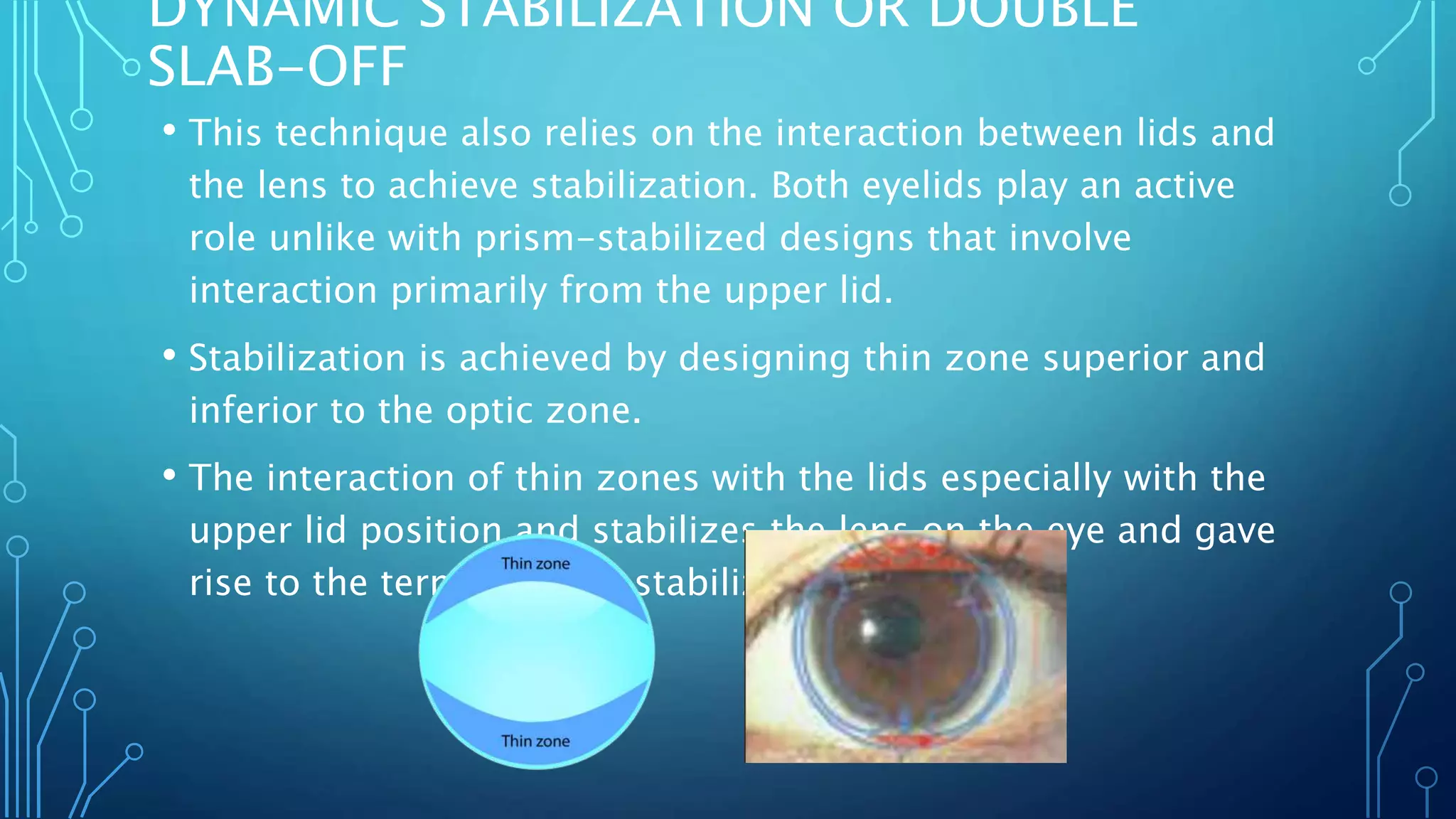 Soft Toric Contact lens | PPTX