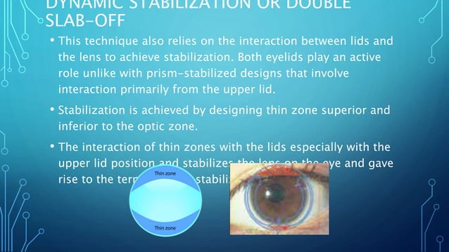 Soft Toric Contact lens | PPTX | Eye and Vision Conditions | Diseases ...