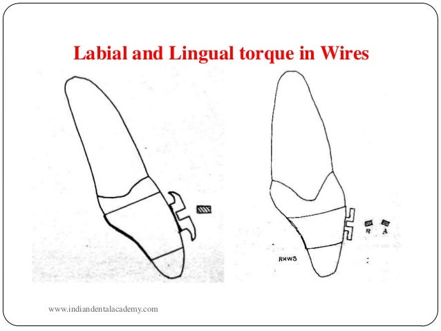 Torque /certified fixed orthodontic courses by Indian dental acade…