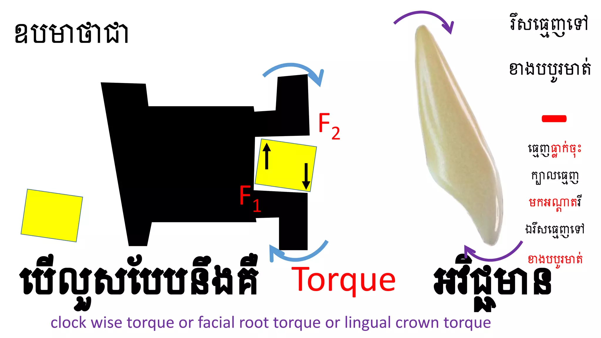 Torque 1 in orthodontics | PPTX