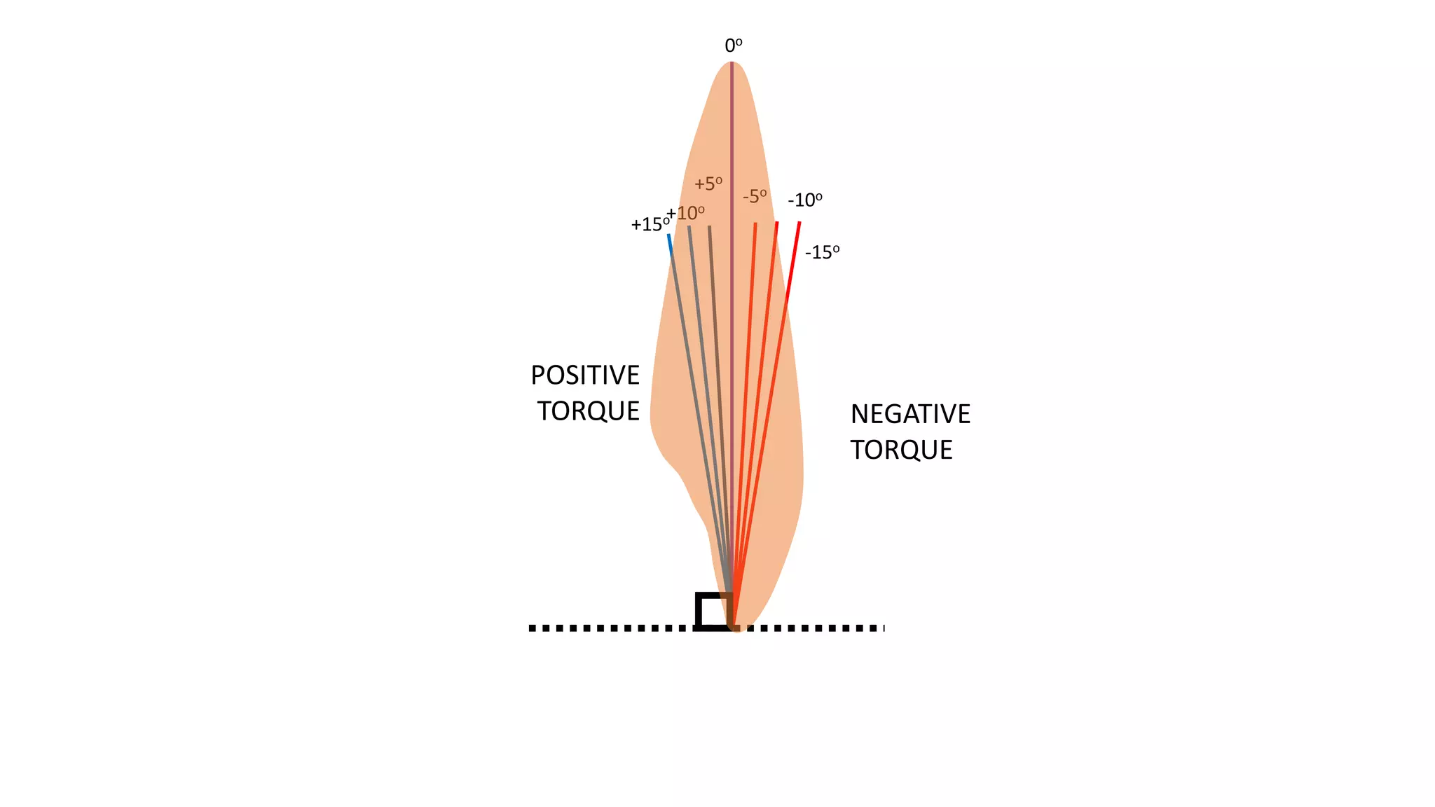 Torque 1 in orthodontics | PPTX