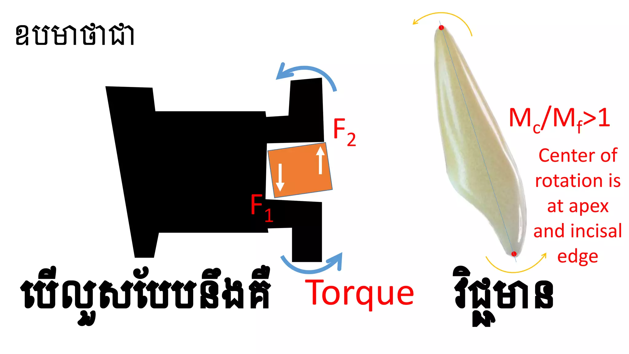 Torque 1 in orthodontics | PPTX