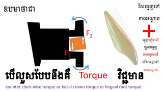 Torque 1 in orthodontics | PPT