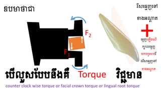 Torque 1 in orthodontics | PPT