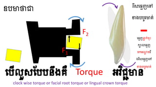 Torque 1 in orthodontics | PPT