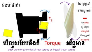 Torque 1 in orthodontics | PPT