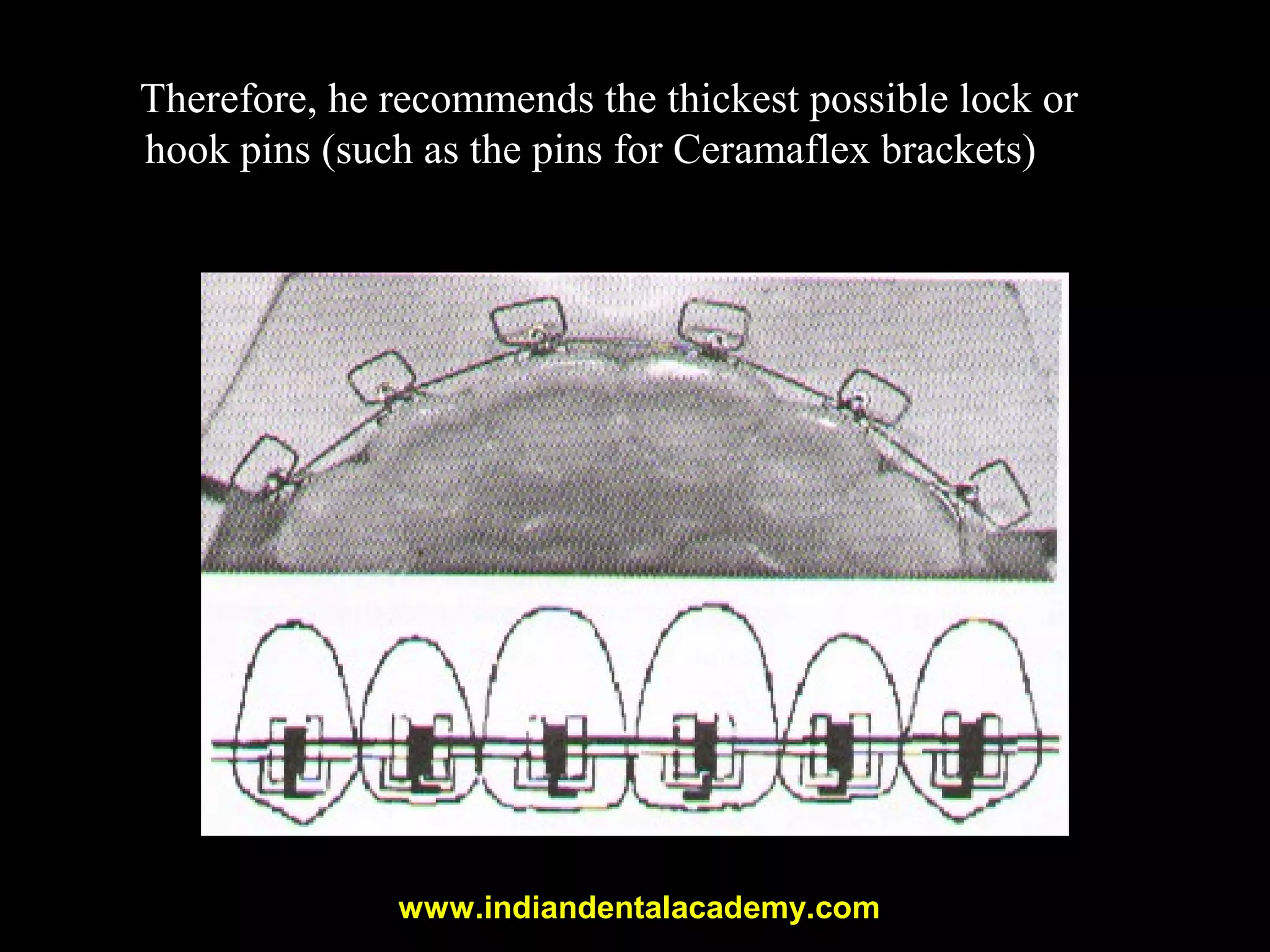 Torquing in orthodontics /certified fixed orthodontic courses by Indian dental academy | PPT ...