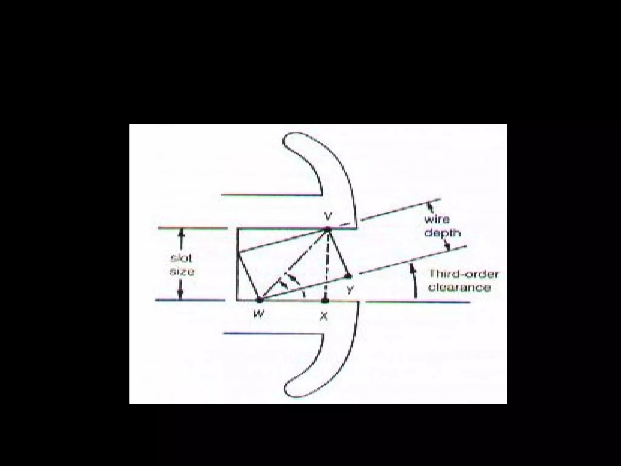 Torquing in orthodontics /certified fixed orthodontic courses by Indian dental academy | PPT