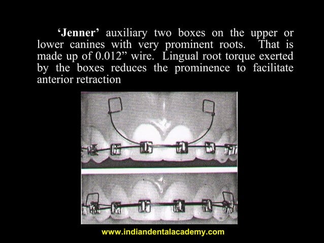 Torquing in orthodontics /certified fixed orthodontic courses by Indian dental academy | PPT