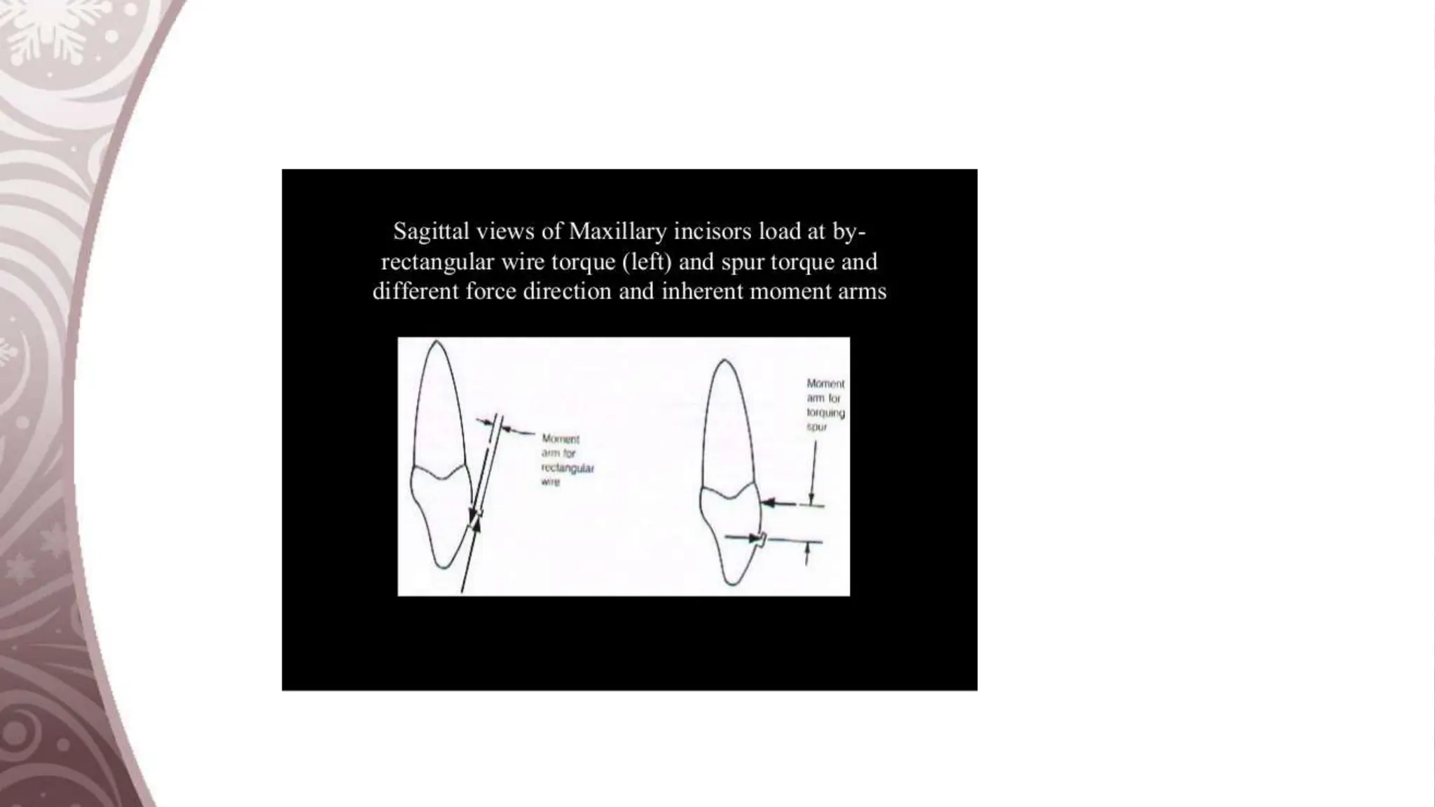 TORQUE AND ITS APPLICATION TO ORTHODONTICS.pptx