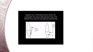 TORQUE AND ITS APPLICATION TO ORTHODONTICS.pptx