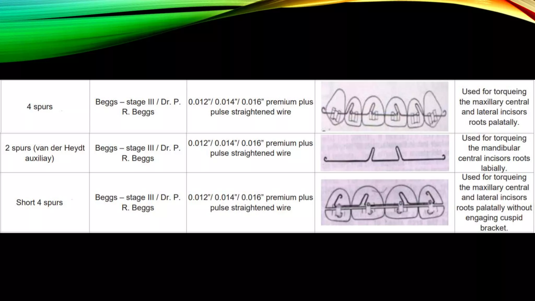 The Root Torqueing Auxiliaries in Orthodontics | PDF
