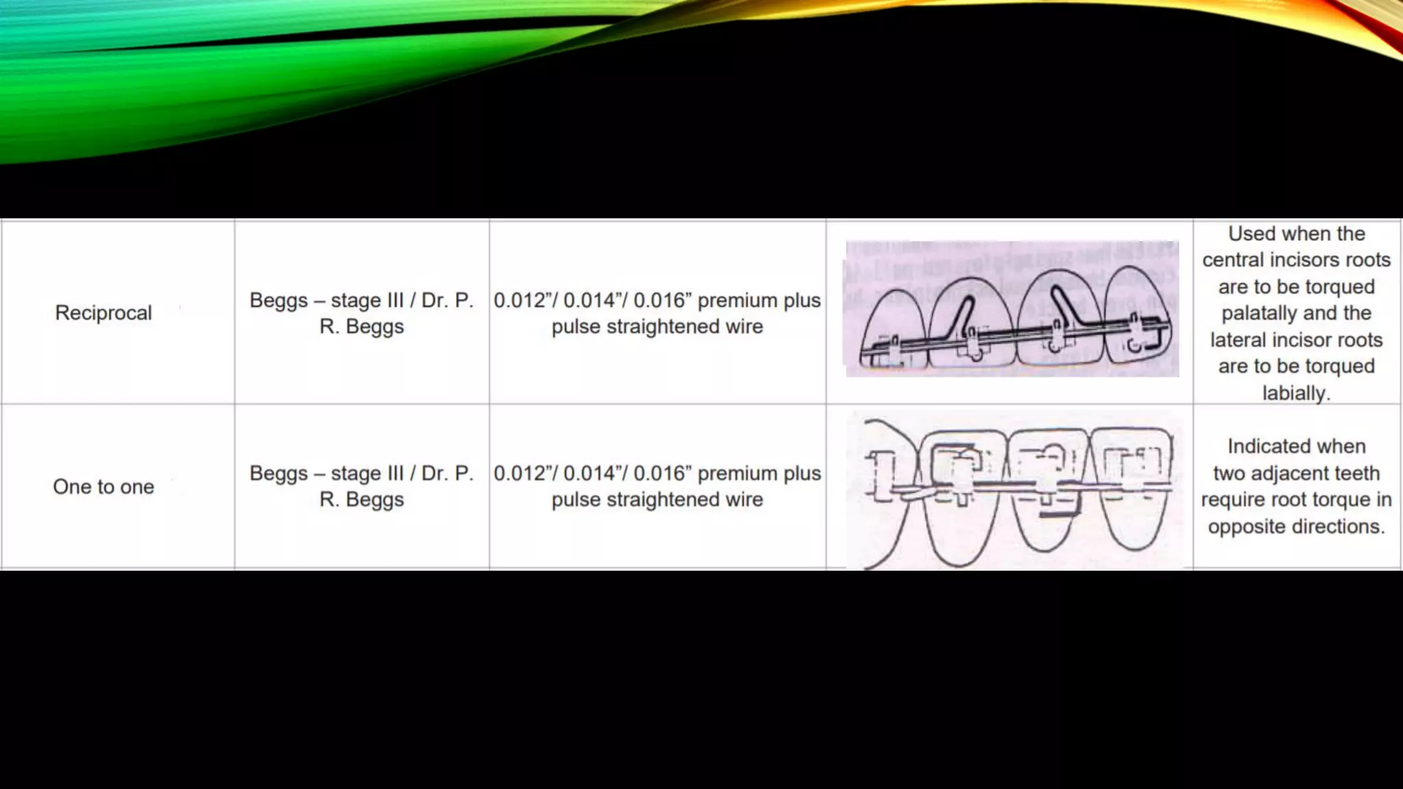The Root Torqueing Auxiliaries in Orthodontics | PDF