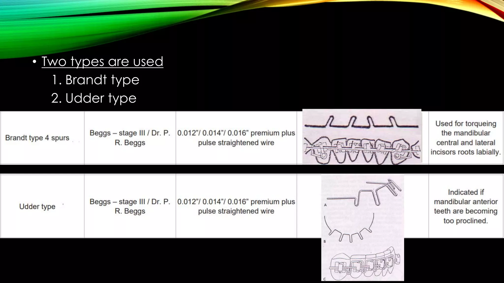 The Root Torqueing Auxiliaries in Orthodontics | PDF