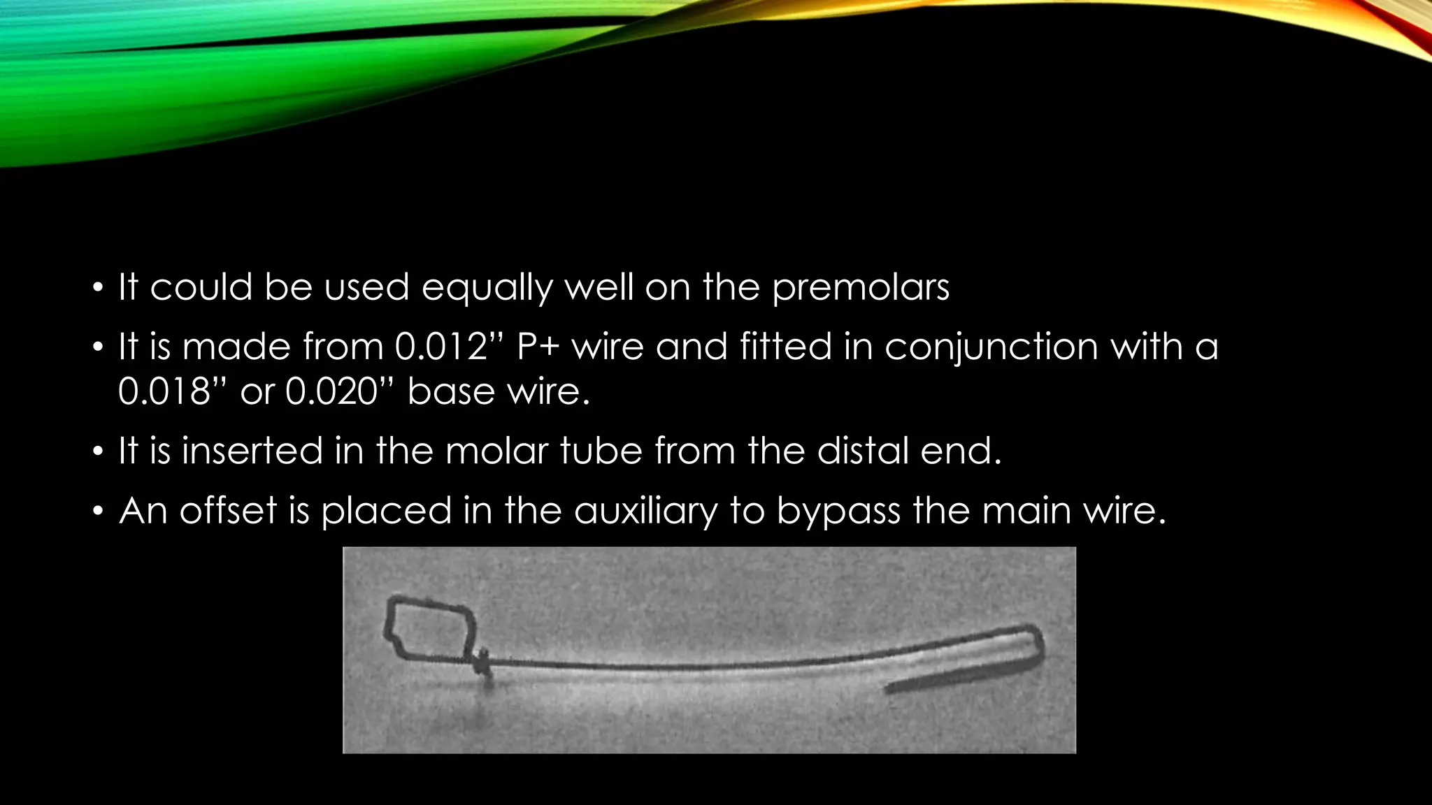 The Root Torqueing Auxiliaries in Orthodontics | PDF