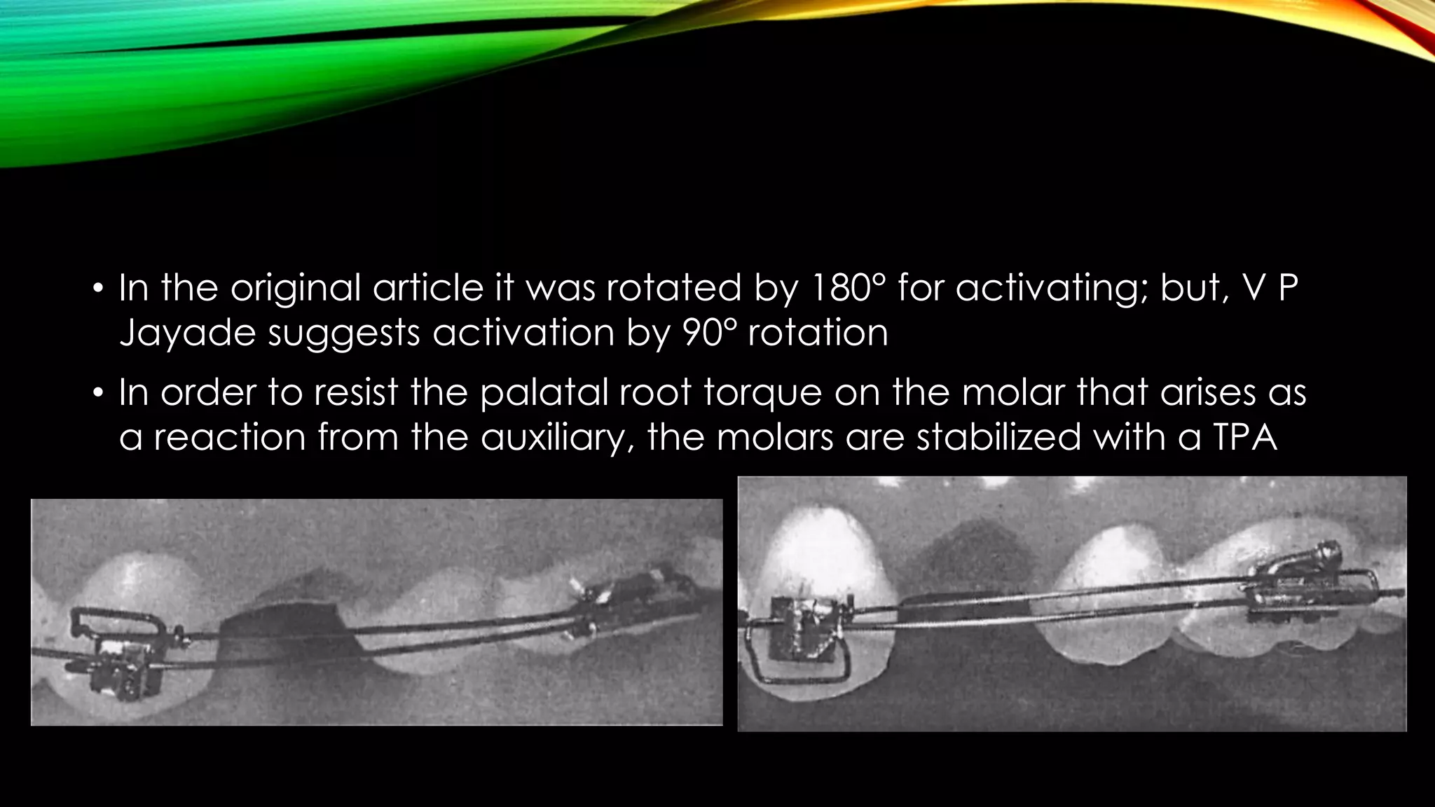 The Root Torqueing Auxiliaries in Orthodontics | PDF