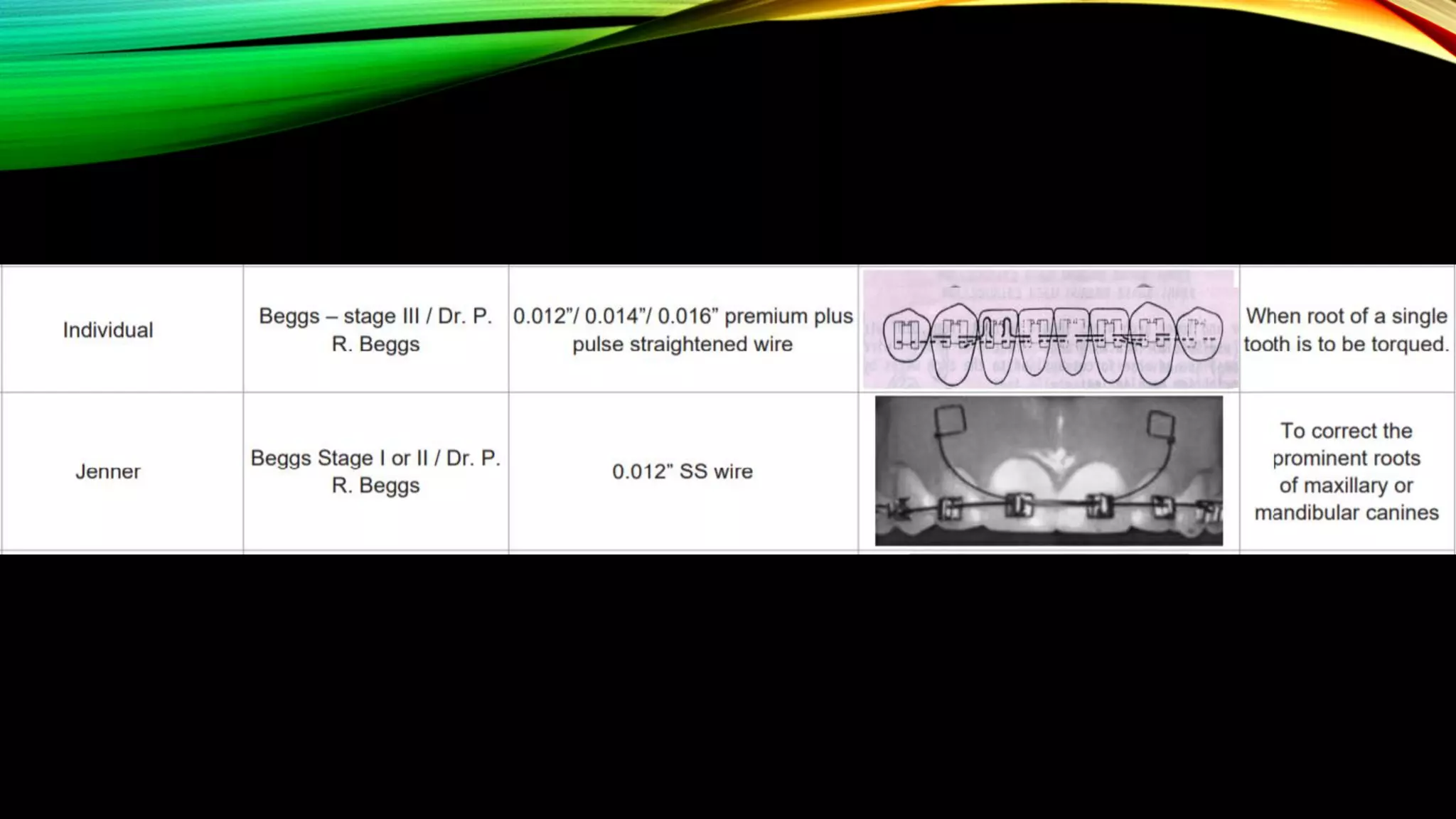 The Root Torqueing Auxiliaries in Orthodontics | PDF