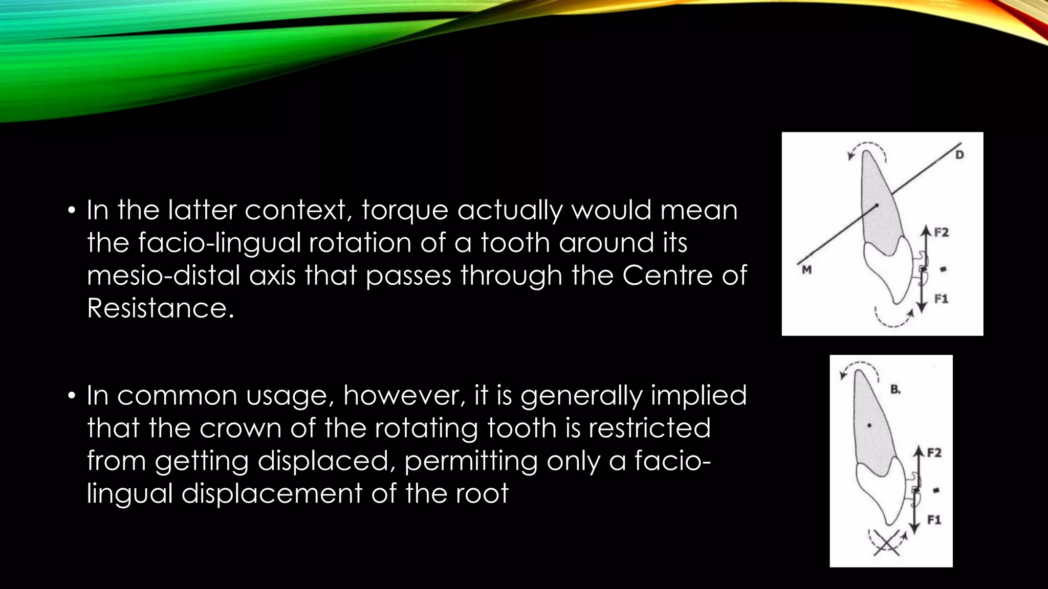 The Root Torqueing Auxiliaries in Orthodontics | PDF
