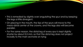 The Root Torqueing Auxiliaries in Orthodontics | PDF