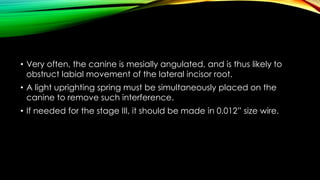 The Root Torqueing Auxiliaries in Orthodontics | PDF