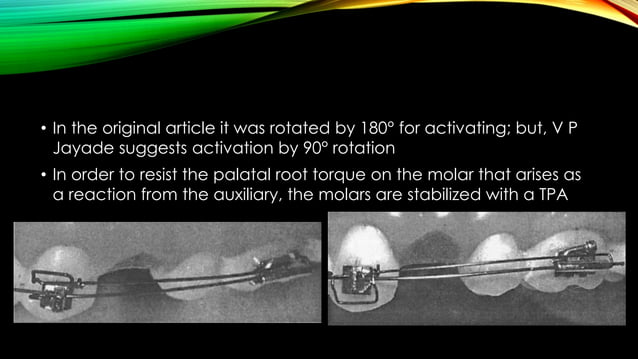 The Root Torqueing Auxiliaries in Orthodontics | PDF | Oral care | Personal Care