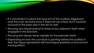 The Root Torqueing Auxiliaries in Orthodontics | PDF