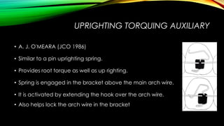 The Root Torqueing Auxiliaries in Orthodontics | PDF