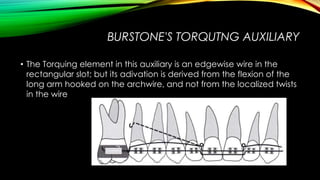 The Root Torqueing Auxiliaries in Orthodontics | PDF