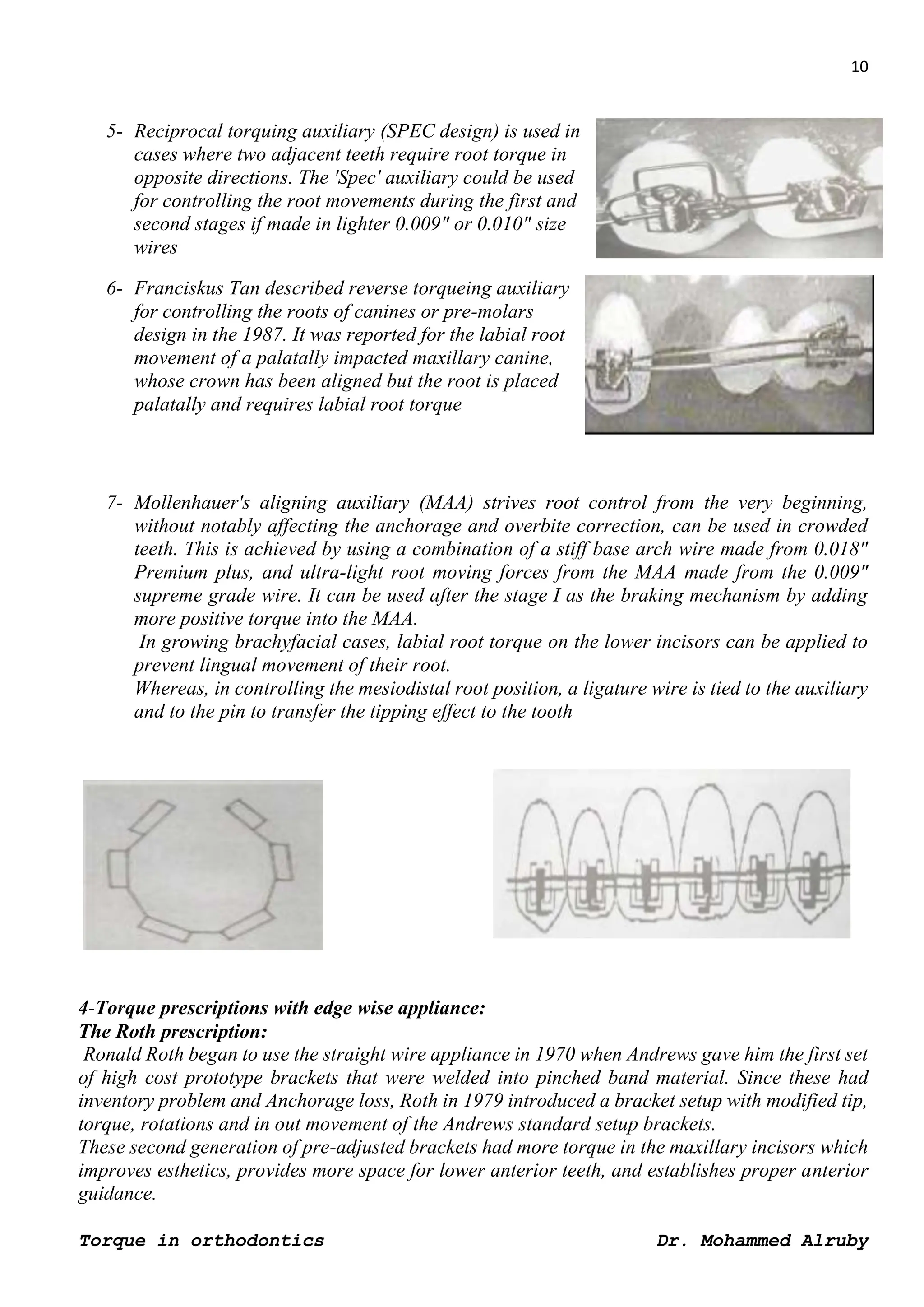 Torque in orthodontics.docx