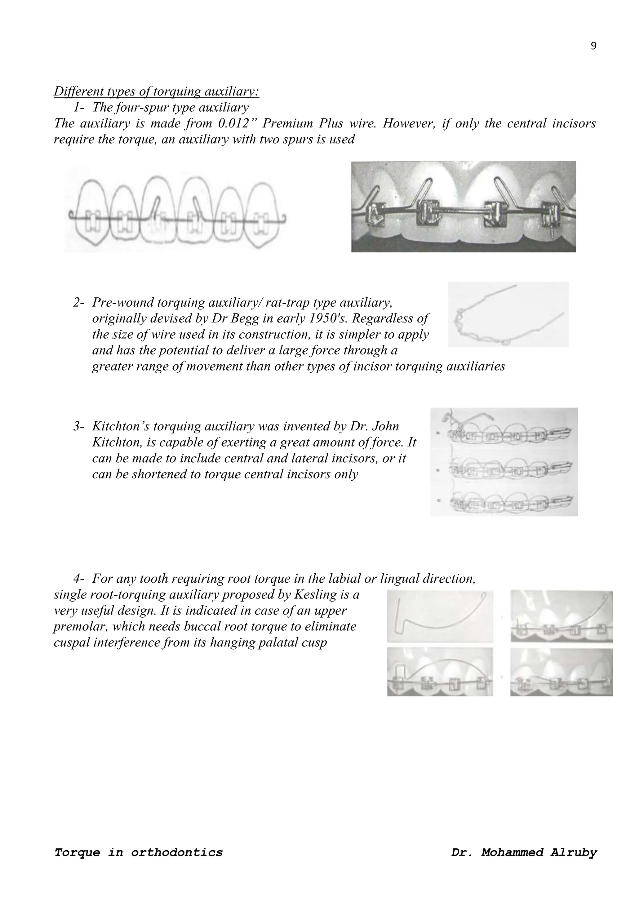 Torque in orthodontics.docx
