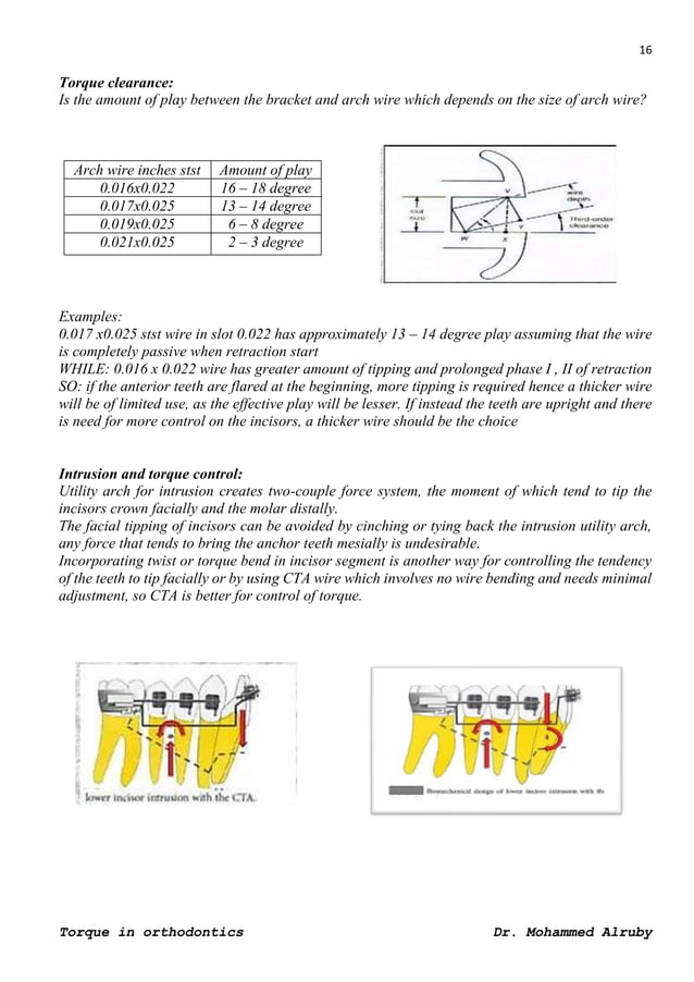 Torque in orthodontics.docx | Dental Health | Diseases and Conditions