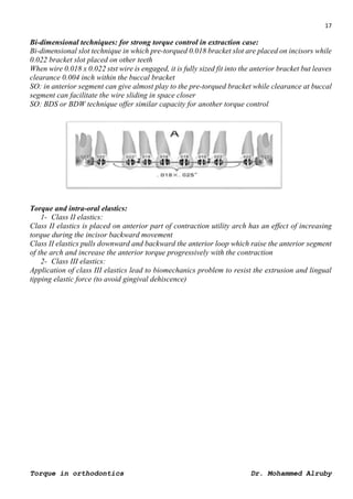 Torque in orthodontics.docx