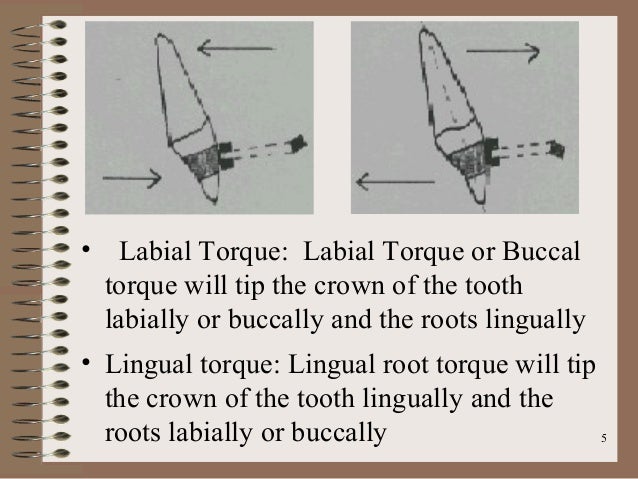 Torque new /certified fixed orthodontic courses by Indian dental…