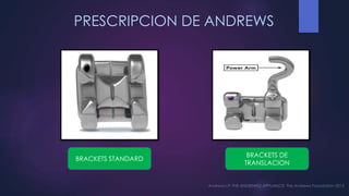 TORQUE Y SUS PRESCRIPCIONES EN LOS DIFERENTES SISTEMAS DE ORTODONCIA ...
