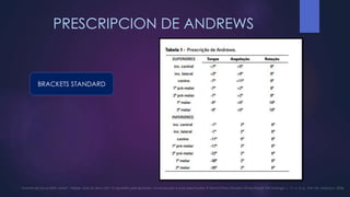 TORQUE Y SUS PRESCRIPCIONES EN LOS DIFERENTES SISTEMAS DE ORTODONCIA ...
