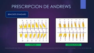 TORQUE Y SUS PRESCRIPCIONES EN LOS DIFERENTES SISTEMAS DE ORTODONCIA ...
