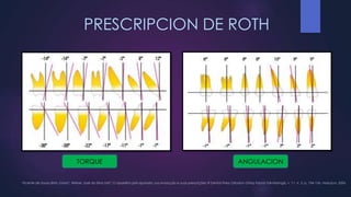 TORQUE Y SUS PRESCRIPCIONES EN LOS DIFERENTES SISTEMAS DE ORTODONCIA ...