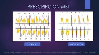 TORQUE Y SUS PRESCRIPCIONES EN LOS DIFERENTES SISTEMAS DE ORTODONCIA ...