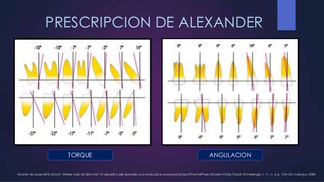 TORQUE Y SUS PRESCRIPCIONES EN LOS DIFERENTES SISTEMAS DE ORTODONCIA