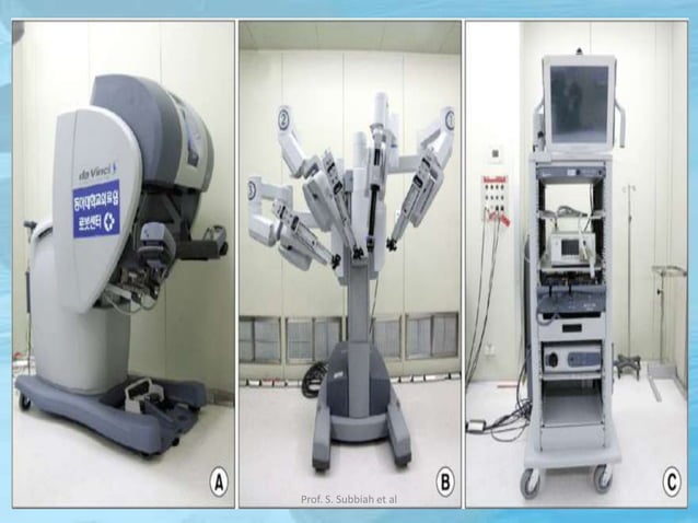 TORS.pptx | Ear, Nose and Throat Conditions | Diseases and Conditions