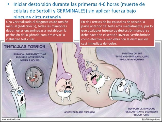 Torsion testicular