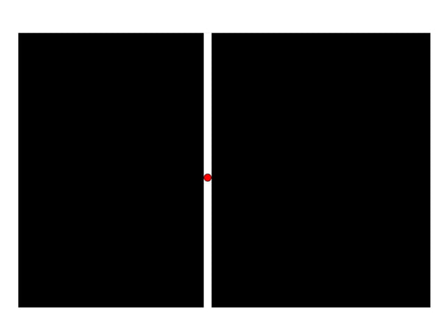 Torsional eye movements | PPT