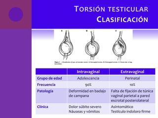 Apendice Testicular