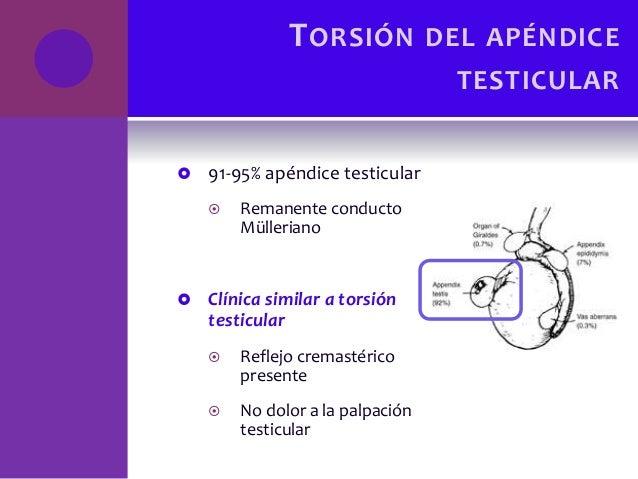 Apendice Testicular